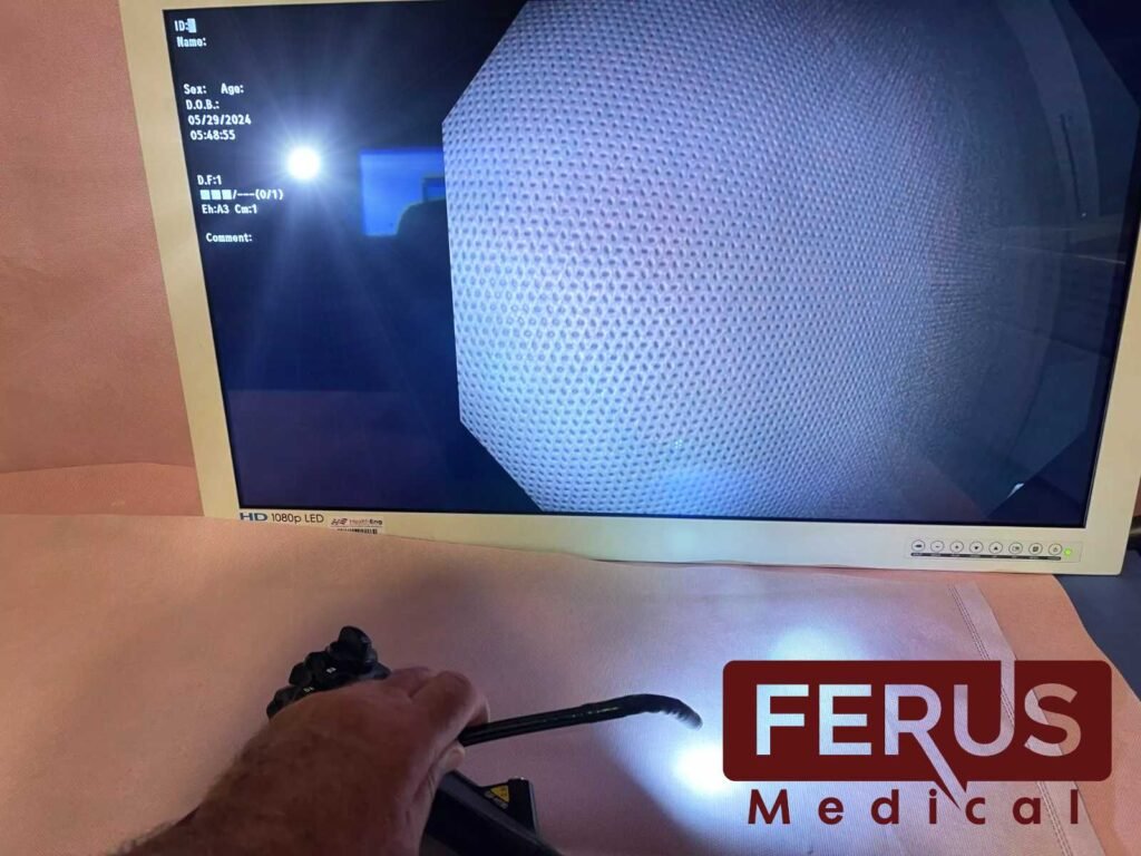 Olympus GIF-H190 gastrointestinal endoscope | ferusmedical.com